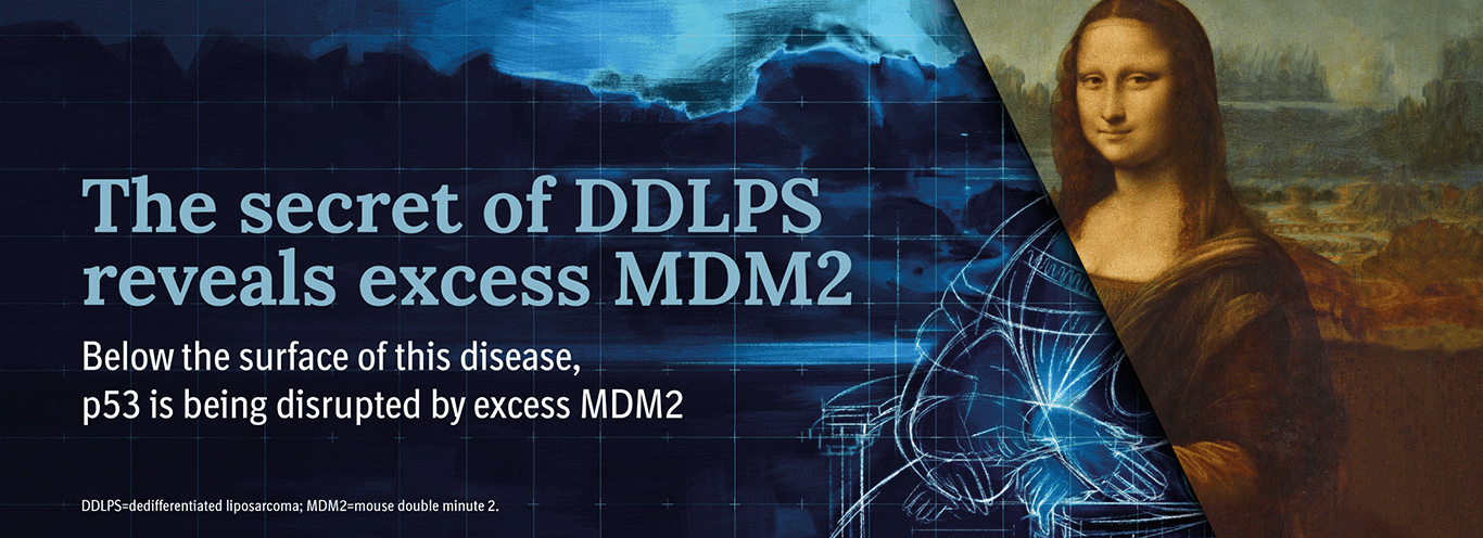 Understanding Dedifferentiated Liposarcoma (DDLPS cancer)